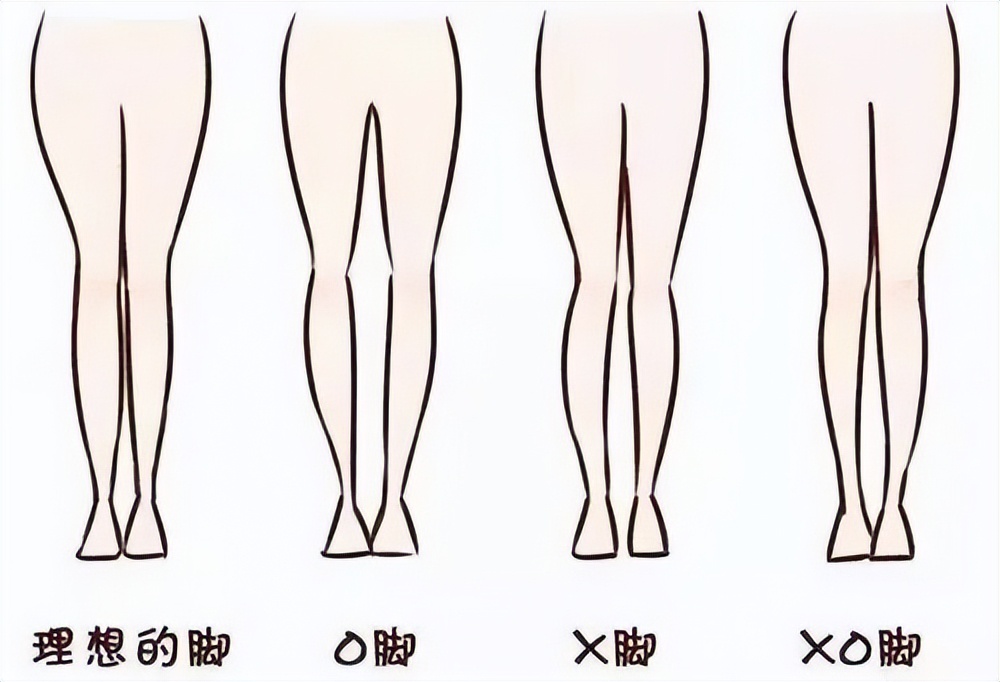 What should I do if the child has abnormal posture and X-shaped legs ...