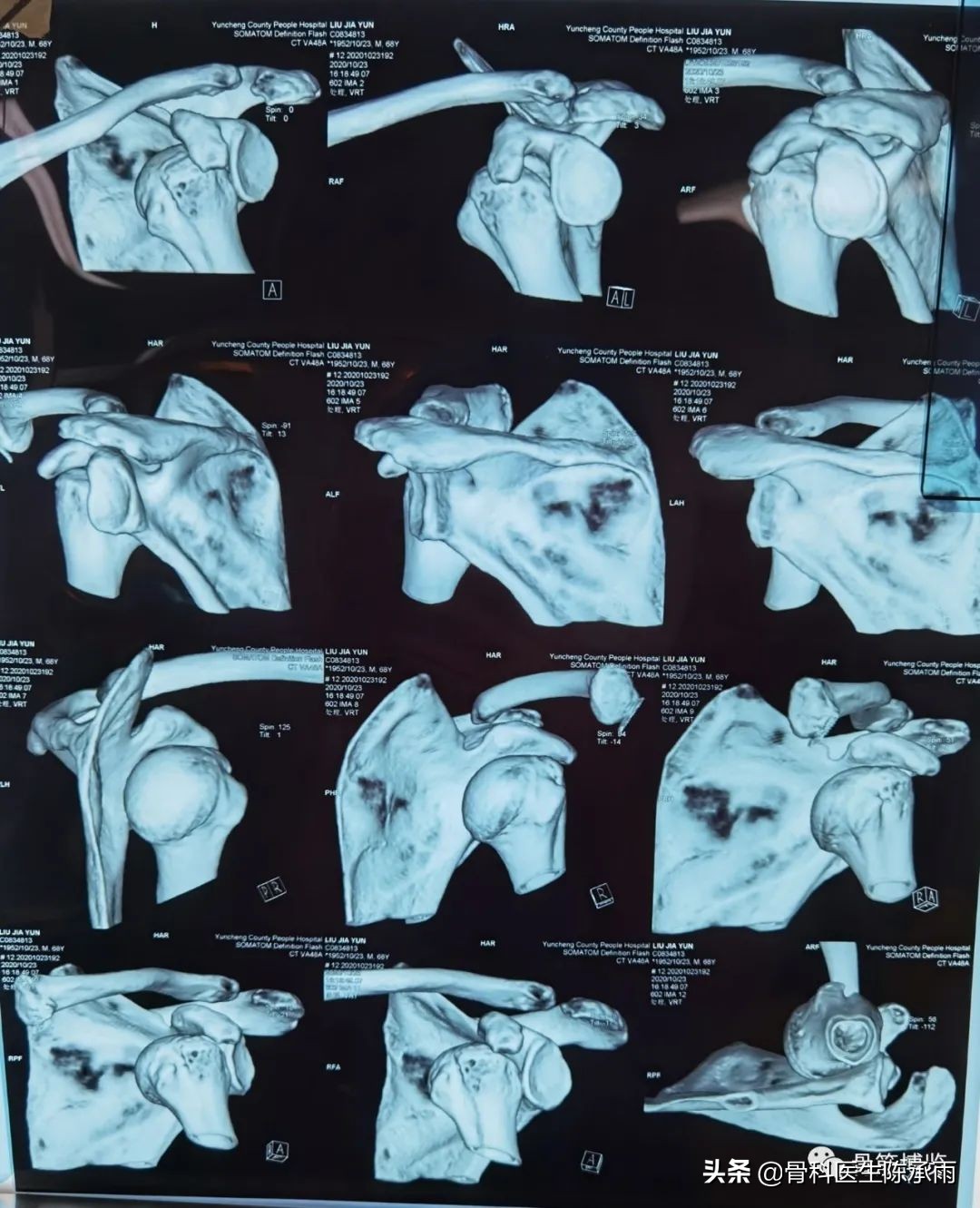 Difficulties still need to be carried on your shoulders, old ...