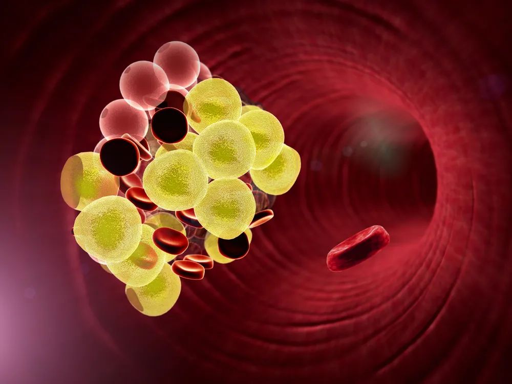 Abnormal blood lipids, look for this reason when eating, especially ...