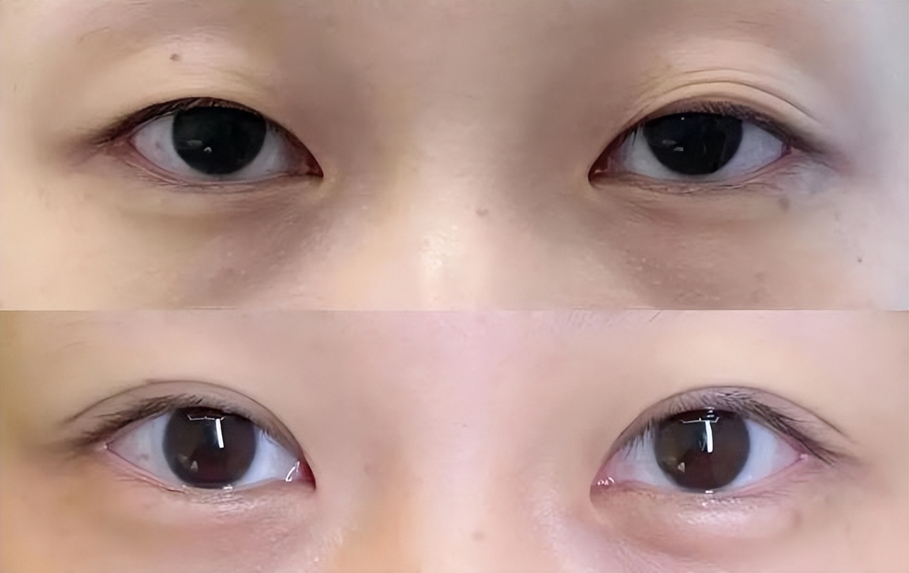 "Little Times" Chen Xuedong——Relying on fine-tuning to realize the ...