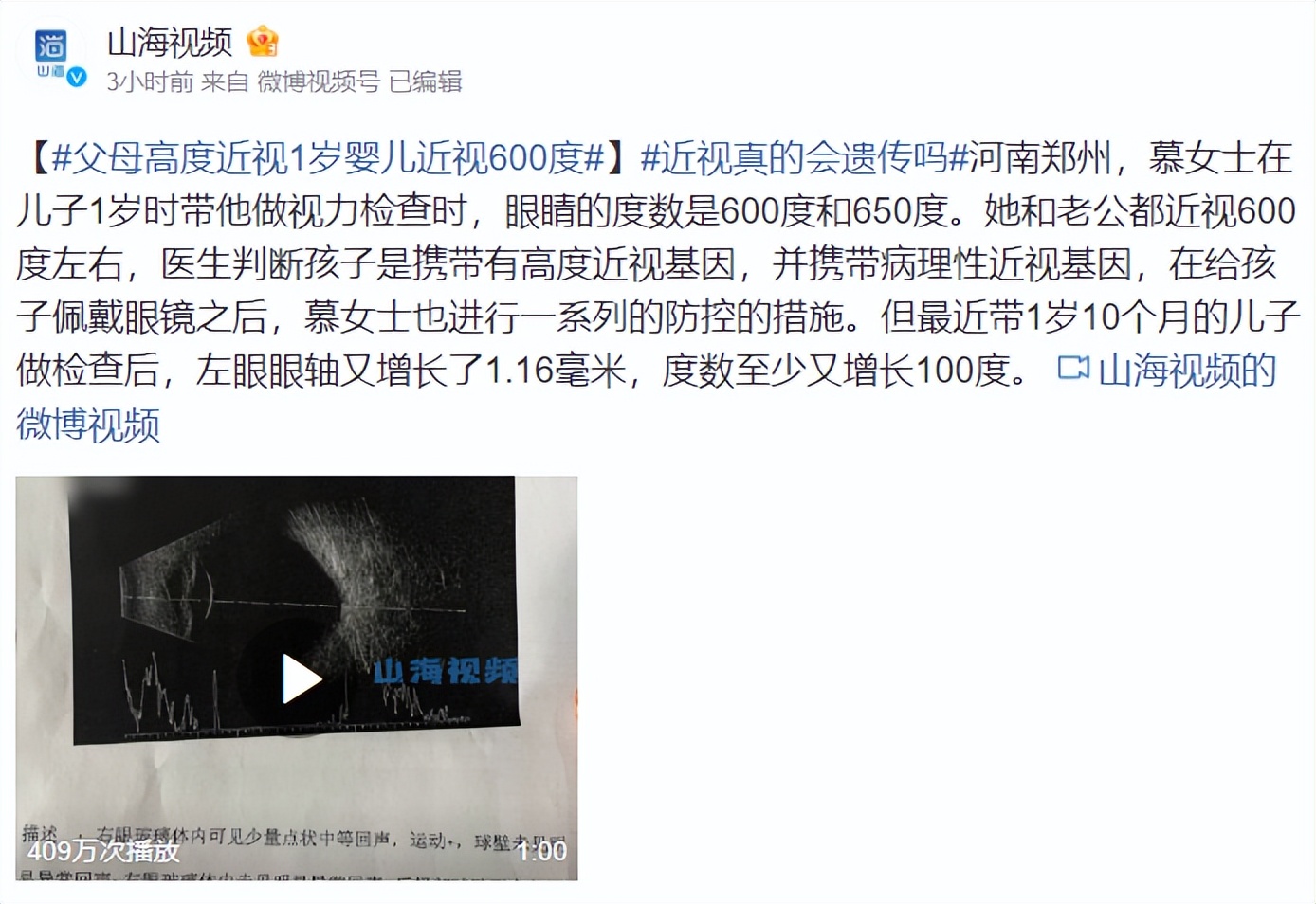 Parents are highly myopic, 1-year-old baby has 600 degrees of myopia ...