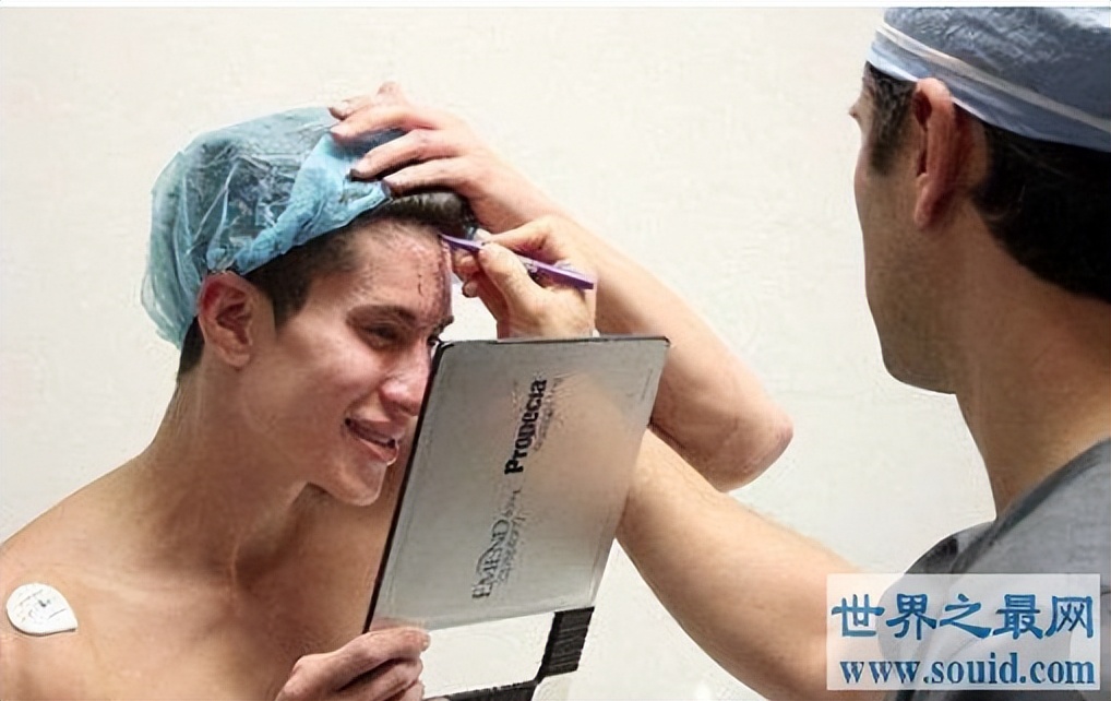 The man with the most plastic surgery in the world, more than 200 ...