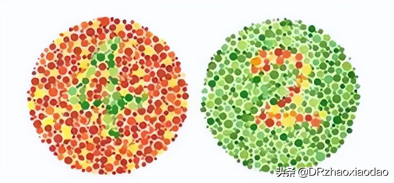 The color is abnormal during the red light treatment. Let's see if ...