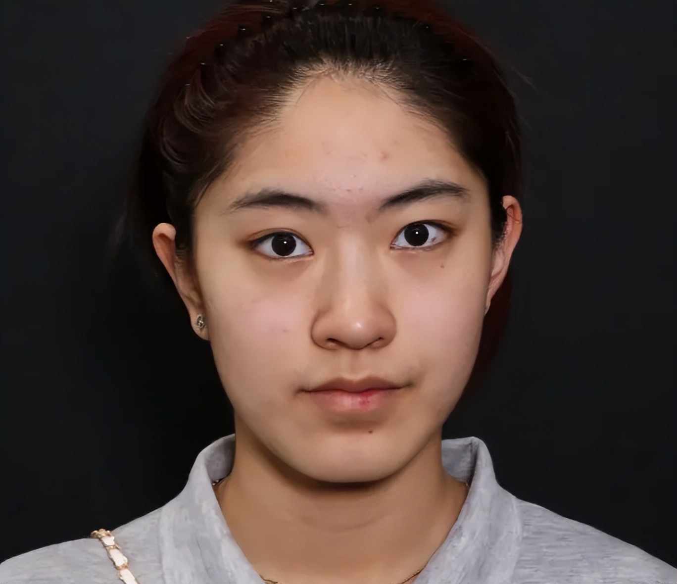 Doctors reveal the key points of "face" good-looking, ordinary doctors ...