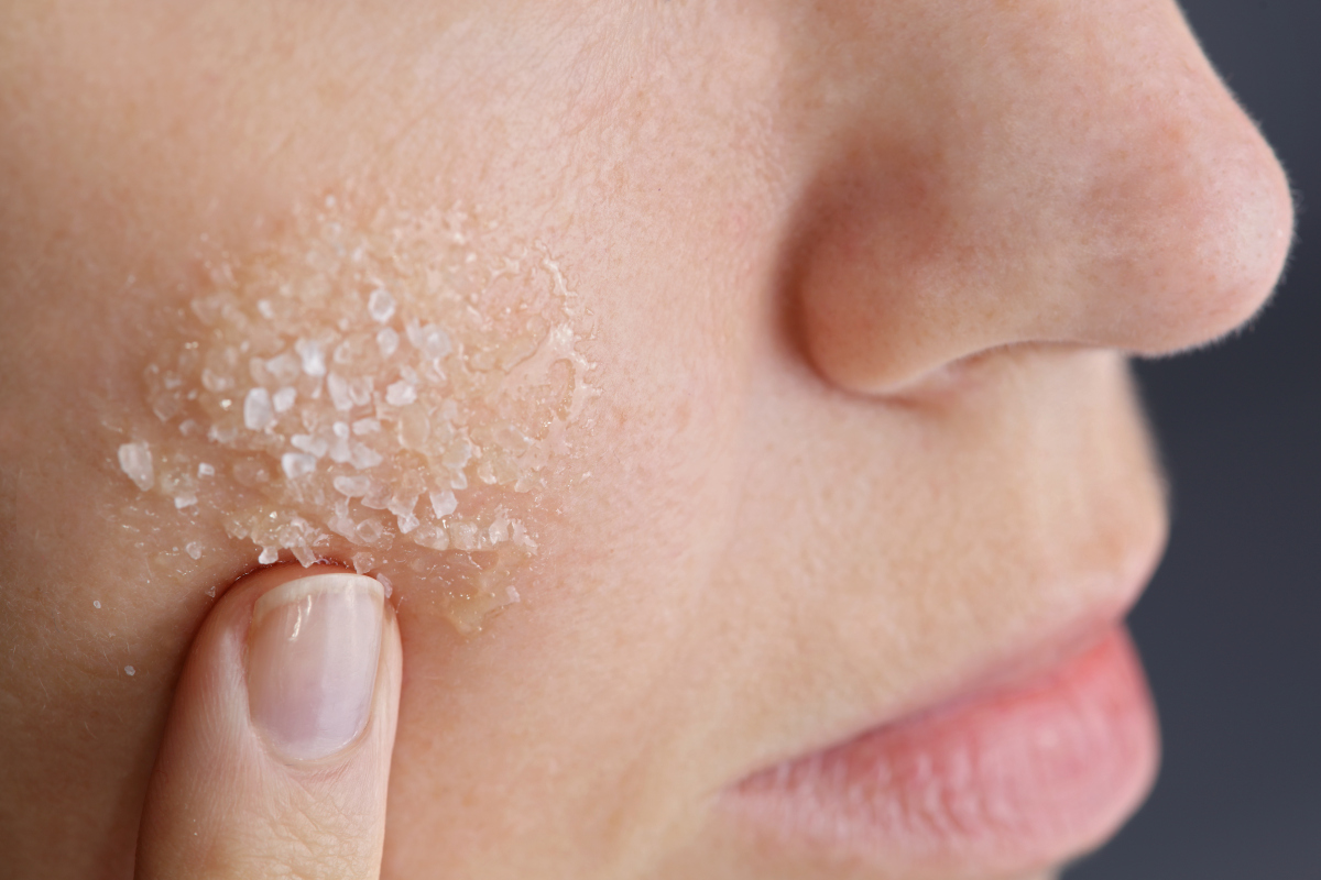How to remove freckles most effectively?In this way, freckle removal ...