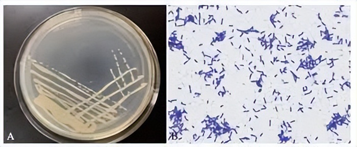 Physiological and biochemical characteristics and naphthalene ...