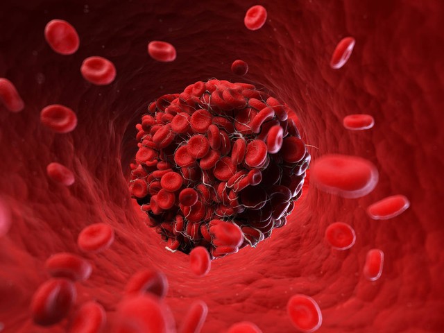 Once the congestion is cleared, all diseases will disappear. A Chinese ...