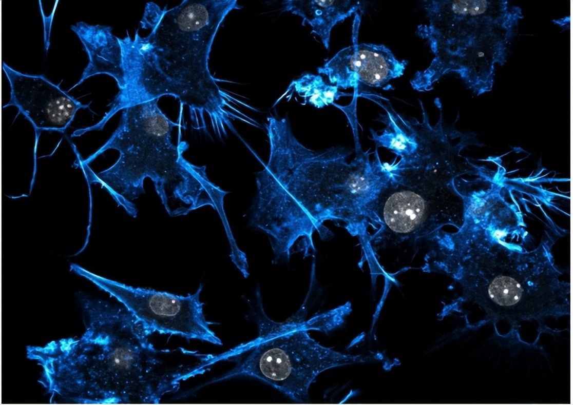 Is sugar an 'accelerator' for cancer cells?Reminder: These 5 kinds of ...