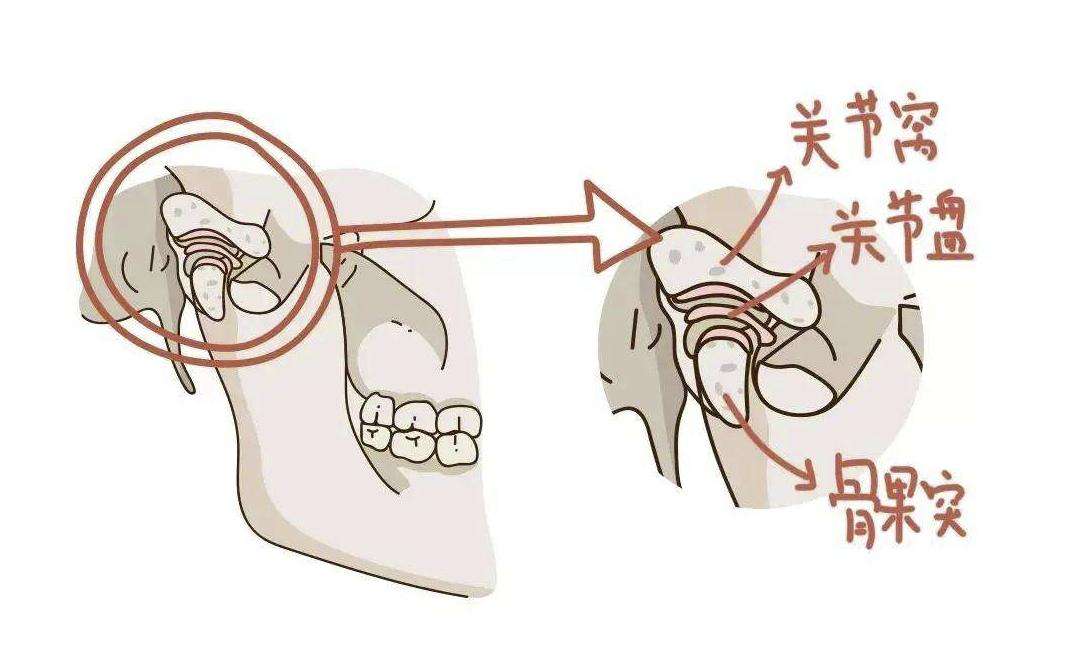 What are the effects of bad bite? - iNEWS