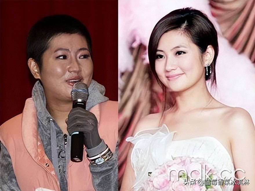 Selina officially announced that she was pregnant. She was severely burned and deformed. Her ...