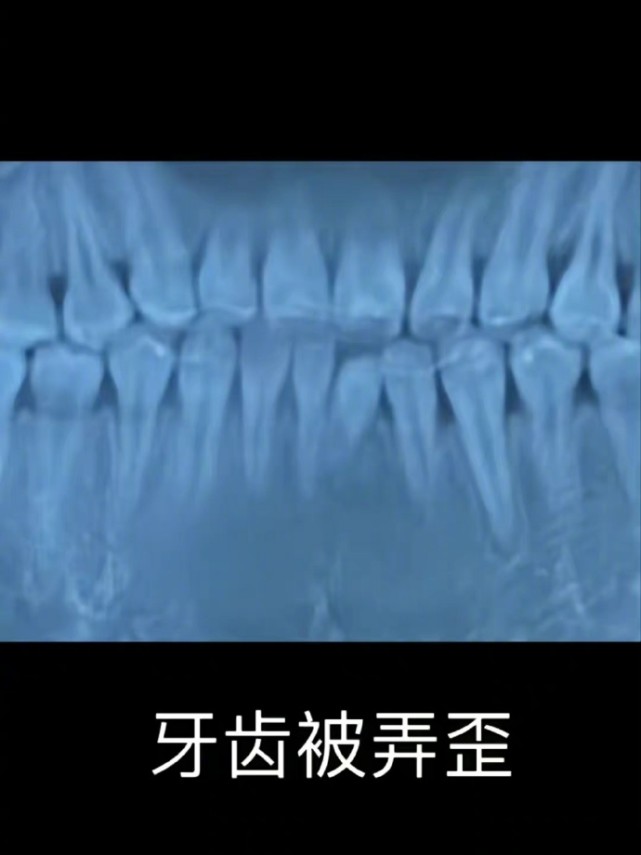 Singer Sevin abused his girlfriend, her nose and teeth were crooked ...