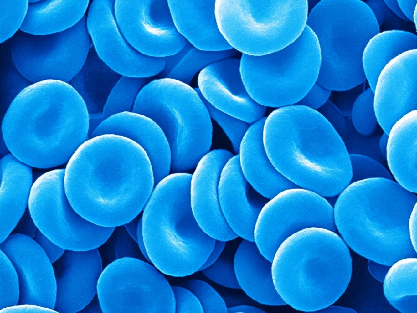 The true story of the genetically mutated blue blood man and his blue ...