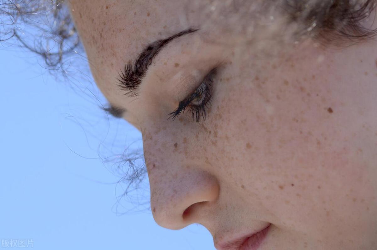 If there are freckles on the face, there must be blood stasis in the ...