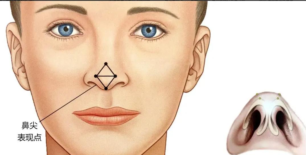 Why is rhinoplasty important? - iNEWS