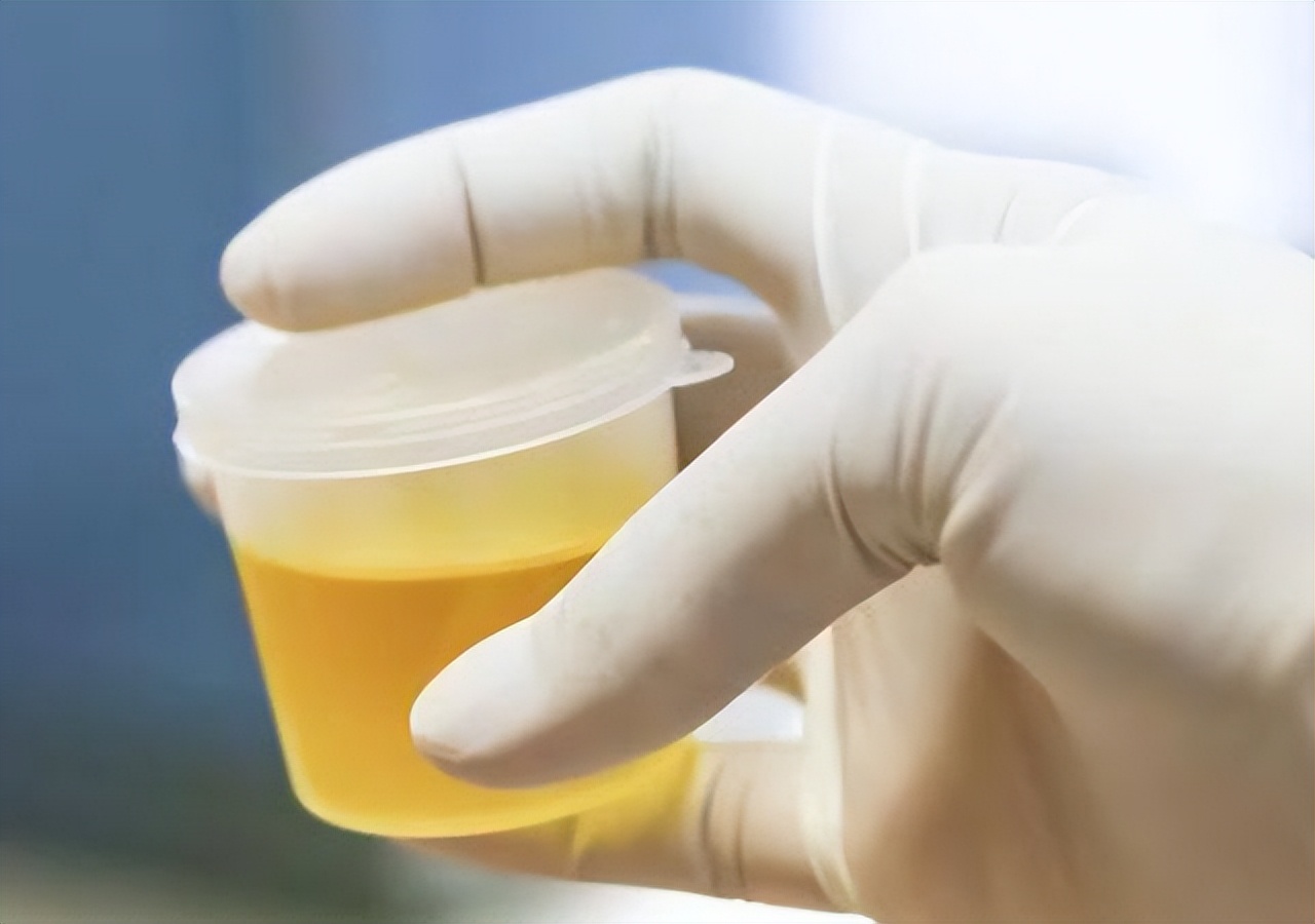 In a day, if the number of male urination is close to "this number ...