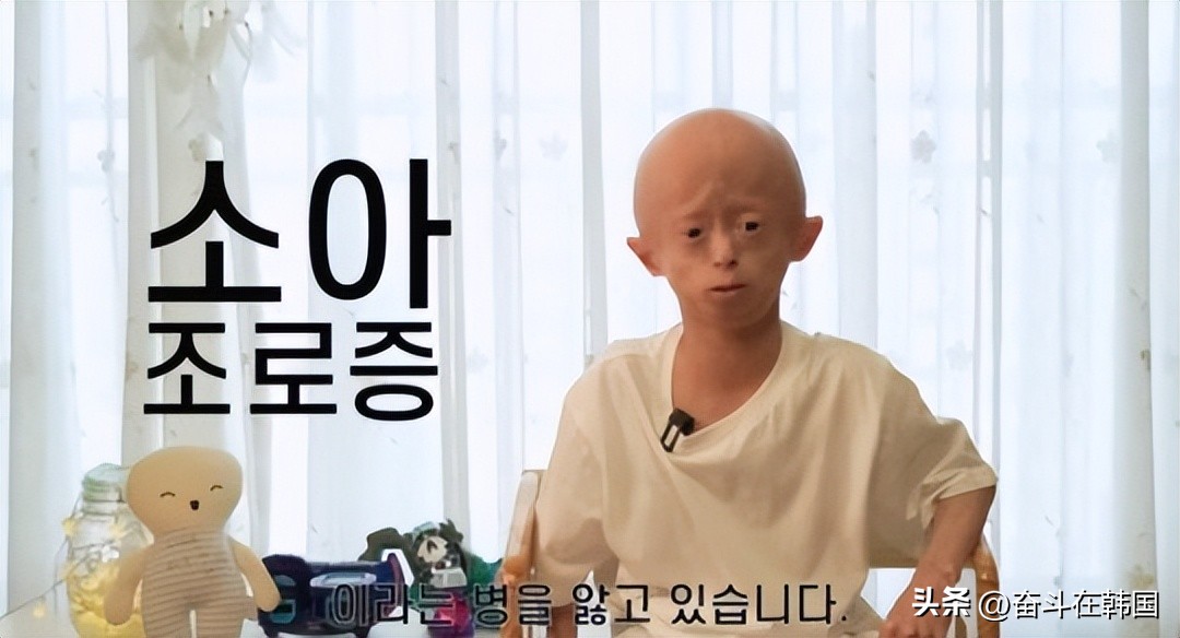 The only child with progeria in South Korea: Every day is the last day ...