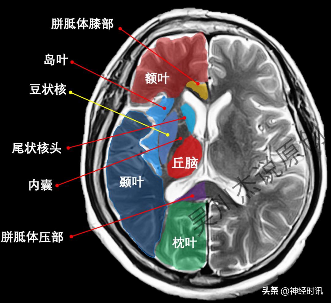 Blood supply of thalamus, clinical symptoms of infarction and related ...