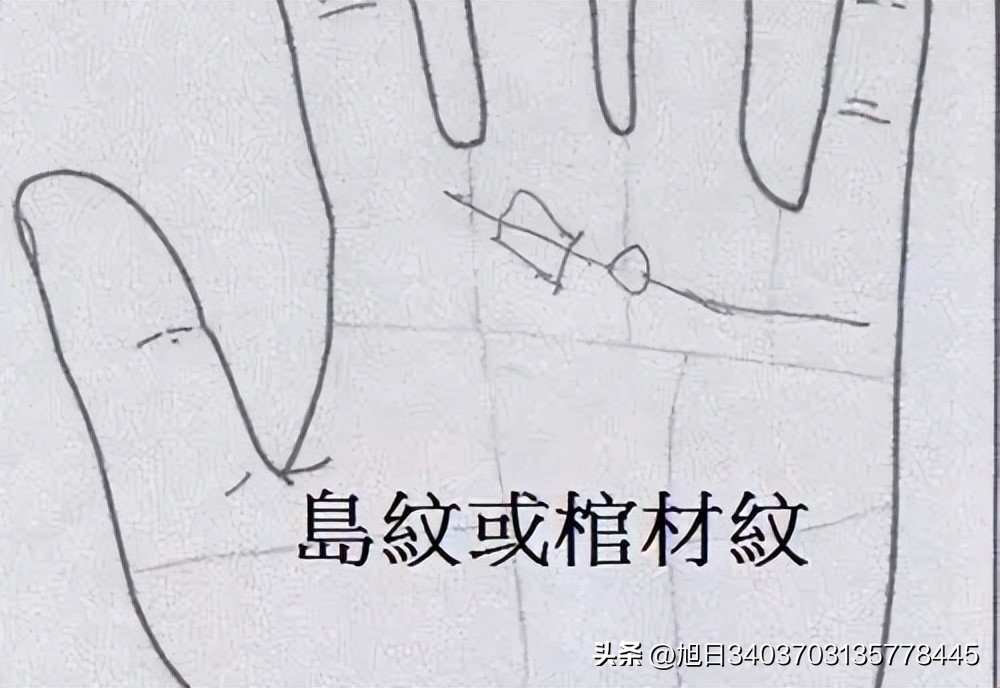 Palmistry: ingot pattern and coffin pattern - iNEWS