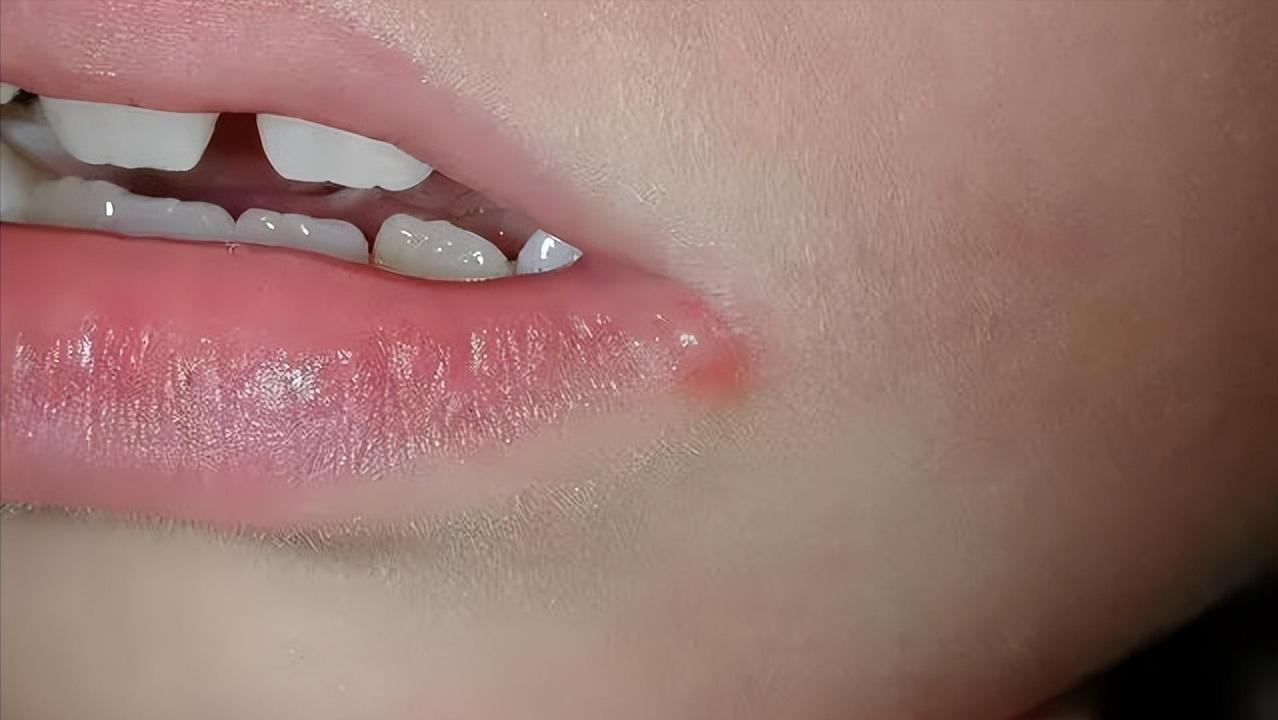 5-year-old son and 2-year-old daughter died of brain after small ...