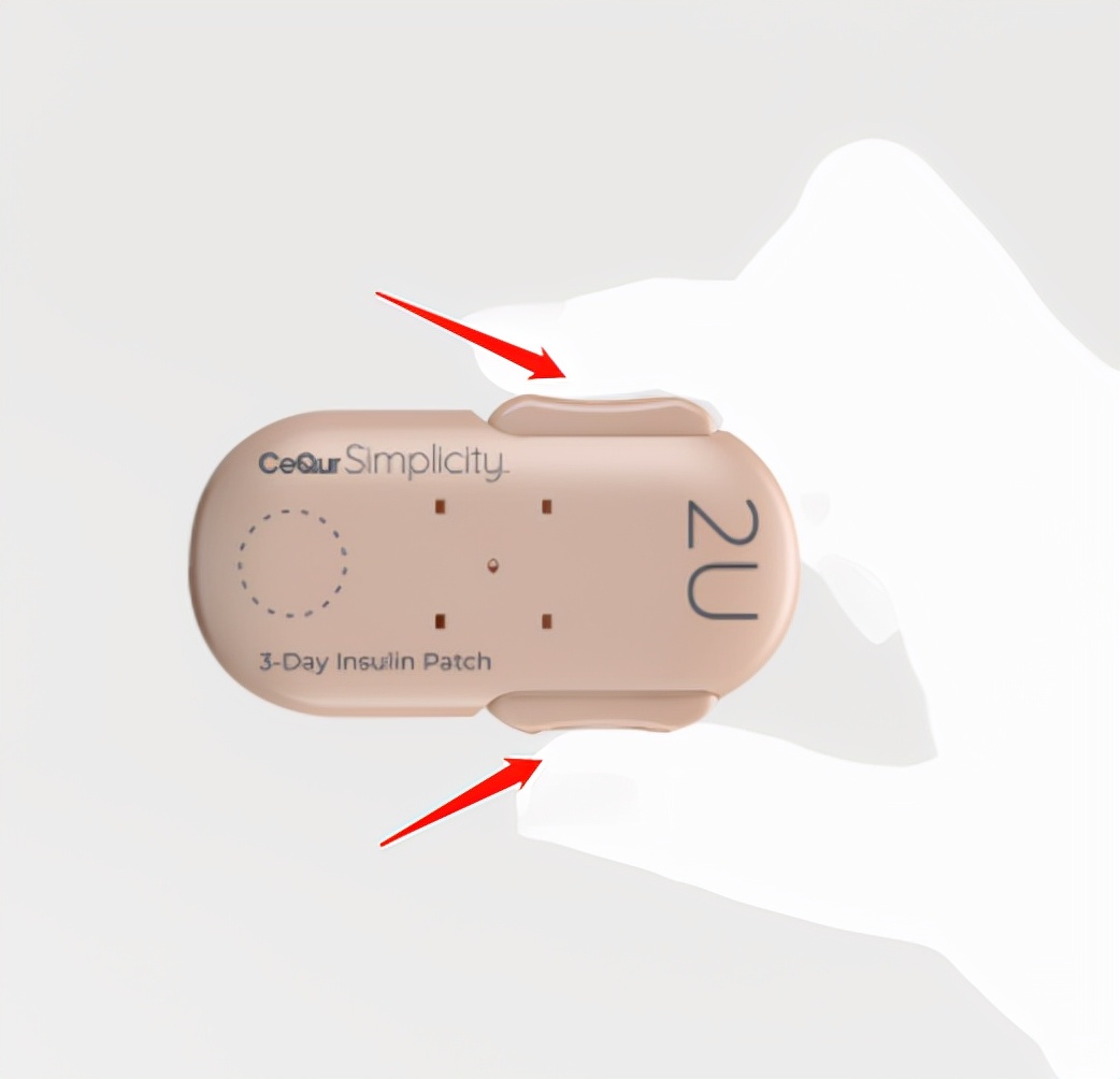 Low-end version of OmniPod?CeQur Simplicity Insulin Patch - iNEWS