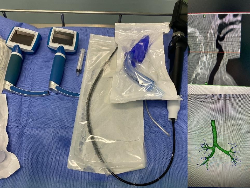 A full record of awake endotracheal intubation - iNEWS