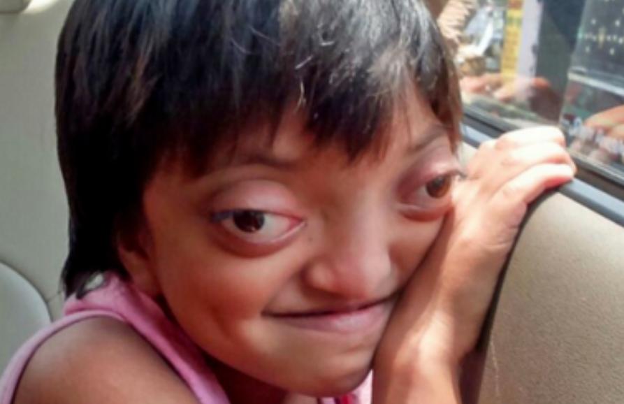 10 actresses who look like "frog eyes": Some people have prominent ...