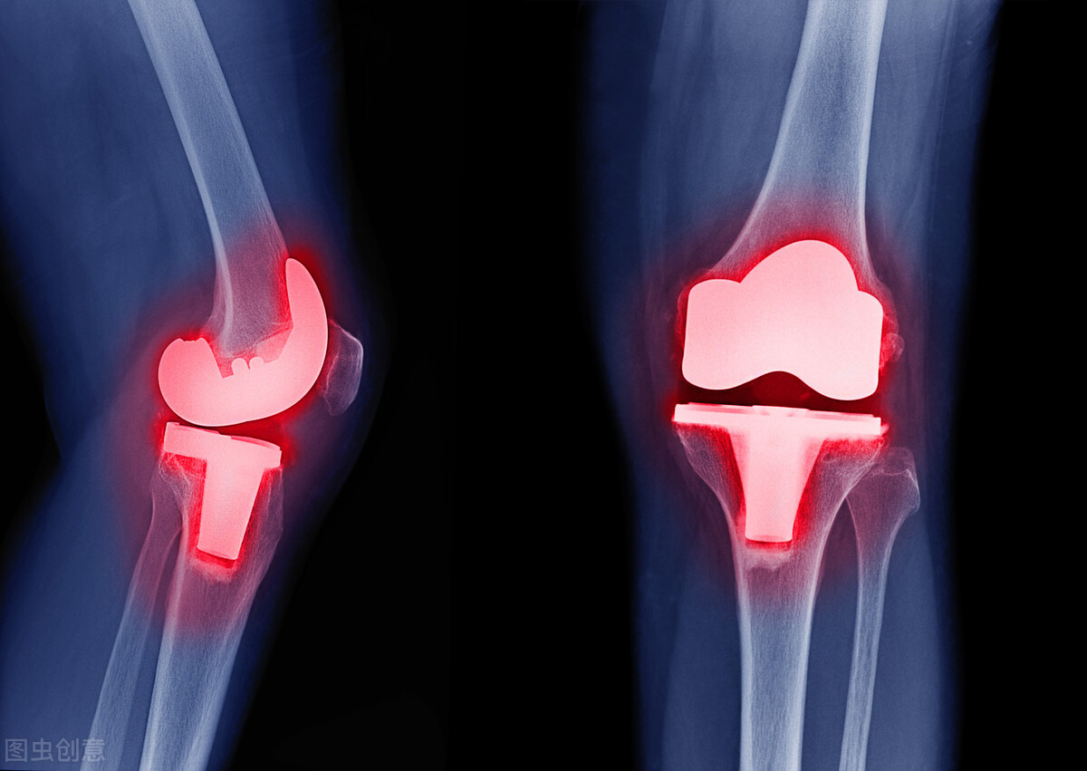 I invite you to take care of your legs together (fourth) ~ How to care ...