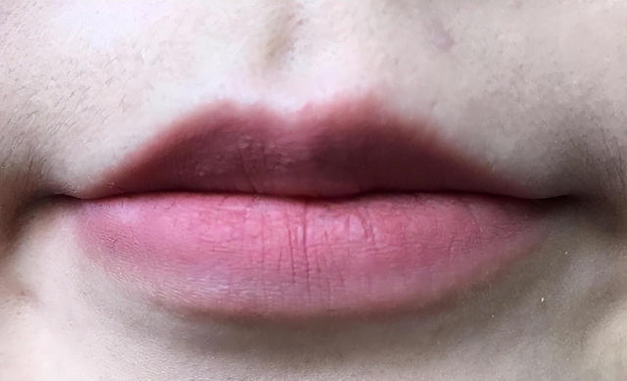 You can tell by looking at your lips if you are in good health?4 lip ...