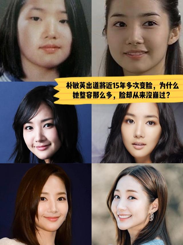 The more neat the more beautiful? As a plastic surgery model sought ...