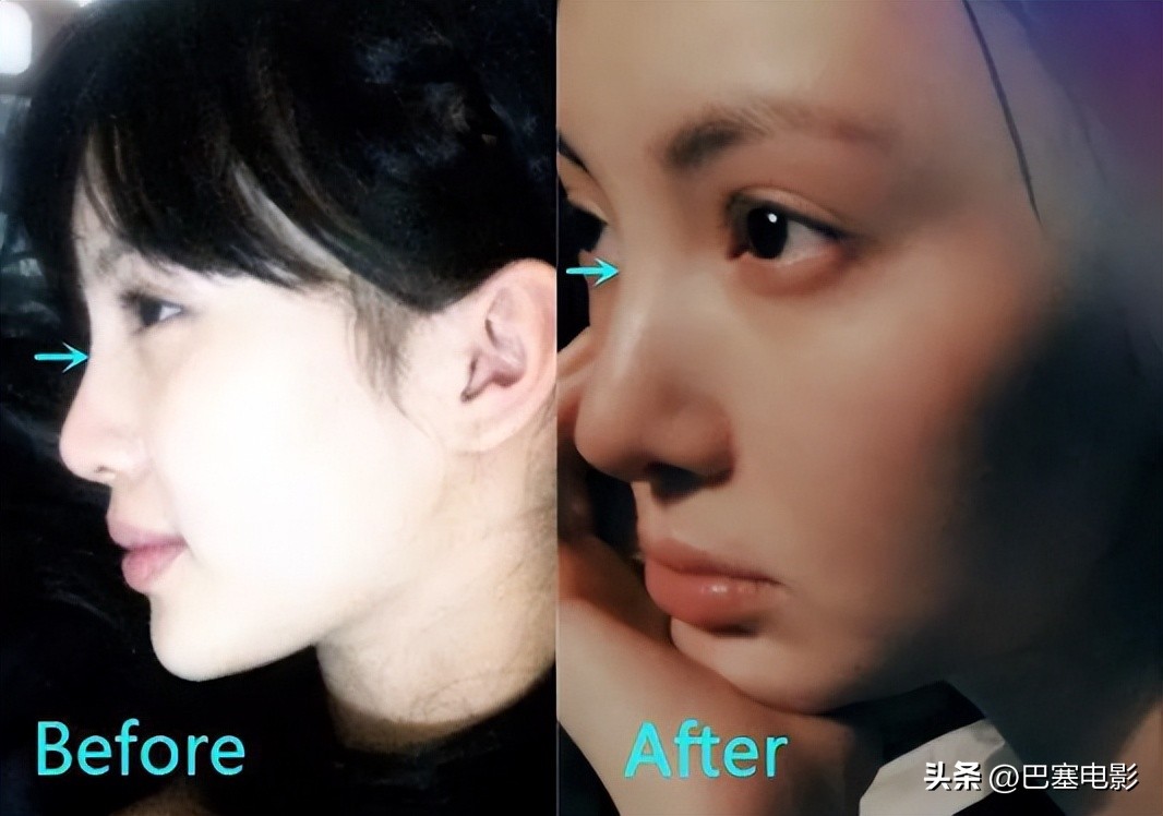 A good beauty has to get her nose, Ruby Lin's nose seems to be caught ...