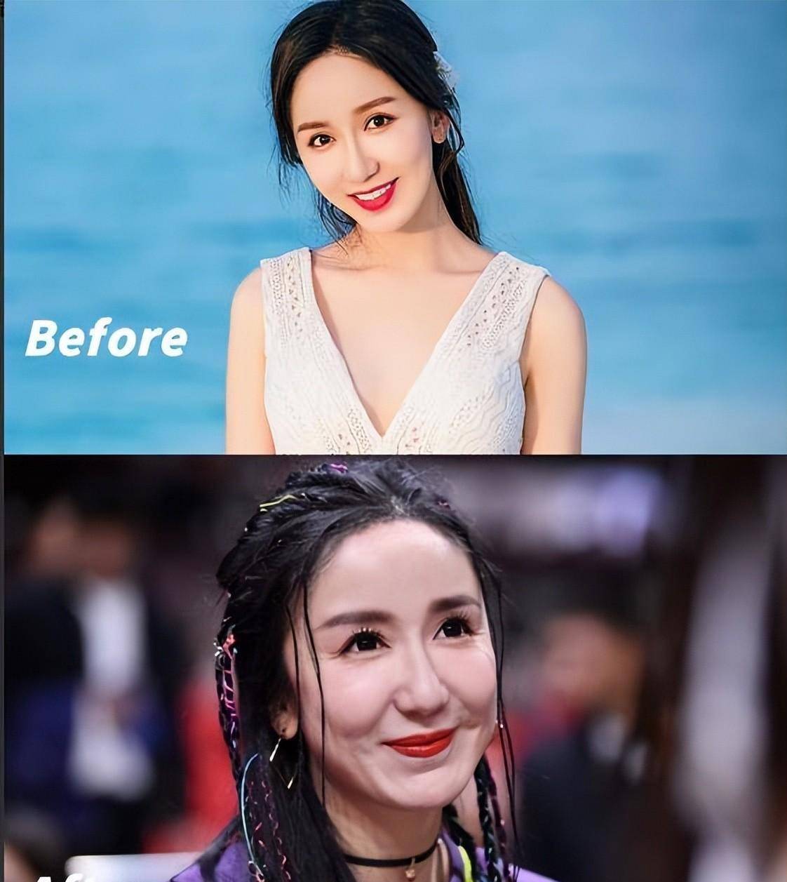 The plastic surgery of 9 actresses "collapsing the house": some ruined their careers, some ...