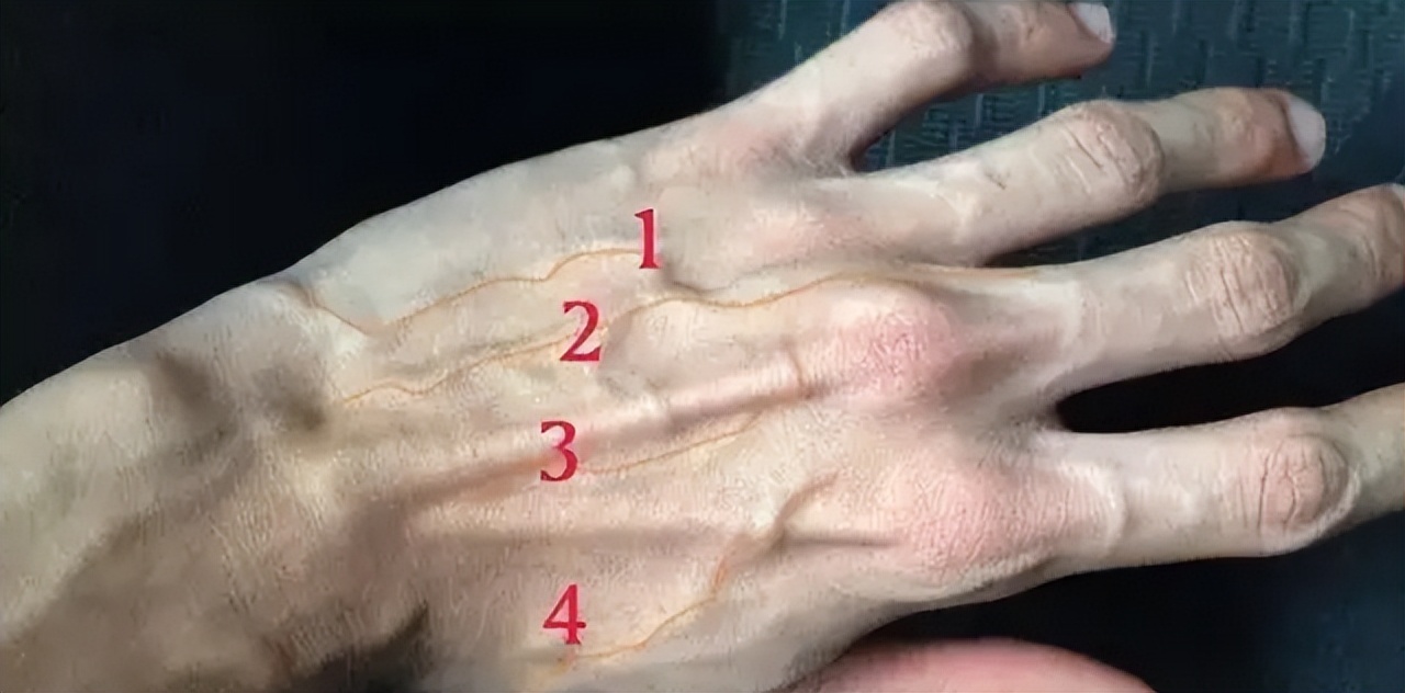 Some people have "blue veins bursting out" in their arms, while some ...