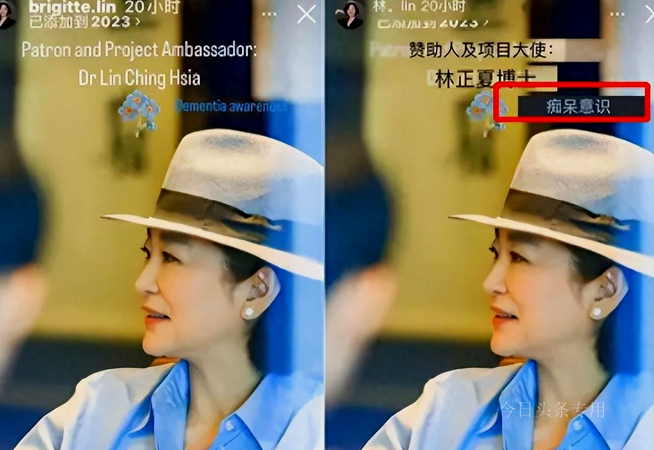 Brigitte Lin is exposed to Alzheimer's disease? Will all the former ...