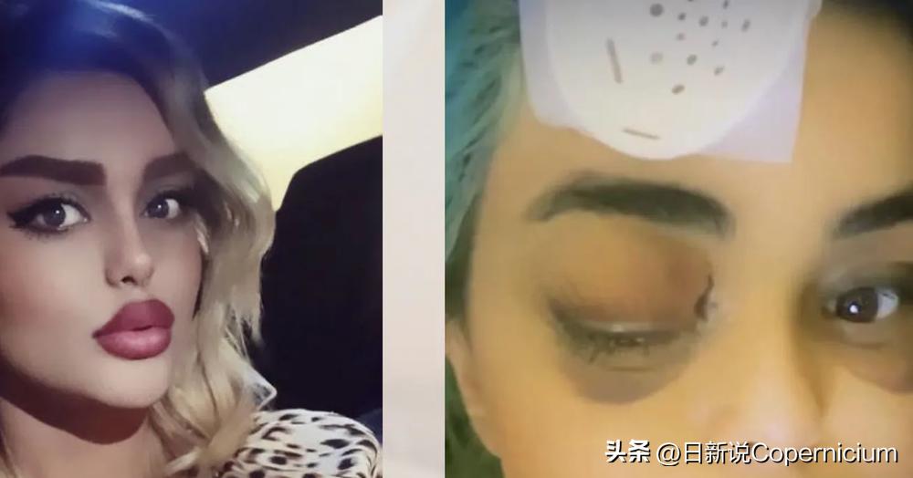 Invisible light: Iran's massive use of blinding weapons to hit ...