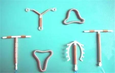 The human body "travel" of the IUD - iNEWS