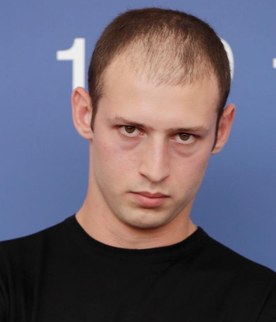 29-Year-Old Israeli Actor Goes Bald in His Twenties With Hair ...