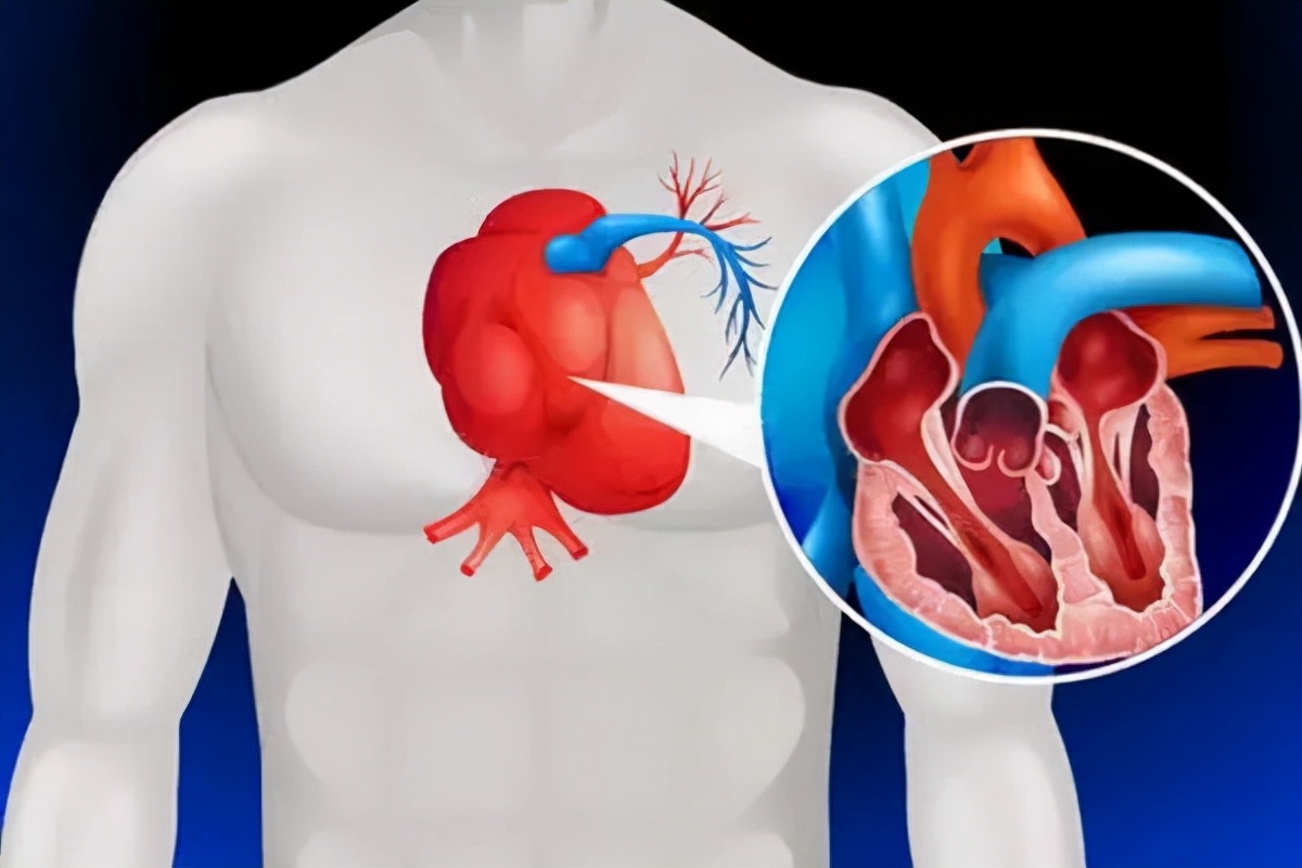 Got hyperthyroidism, flustered and uncomfortable?Watch out for ...