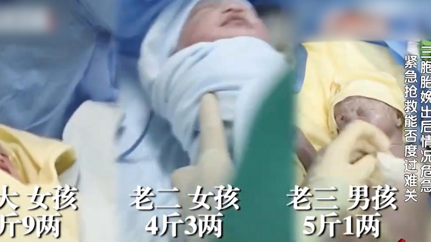 How hard is it to have triplets? The woman's belly was stretched to be ...