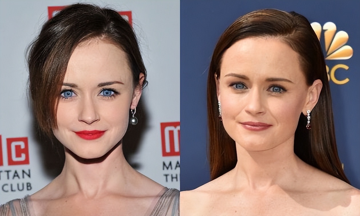 12 Hollywood stars with iconic body parts: Implants and injections work ...