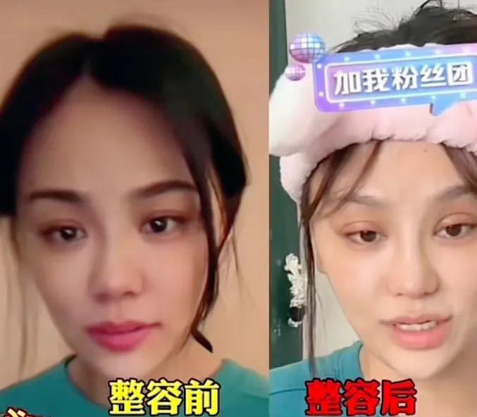 Fan Xiaohui changed her appearance after plastic surgery and ...