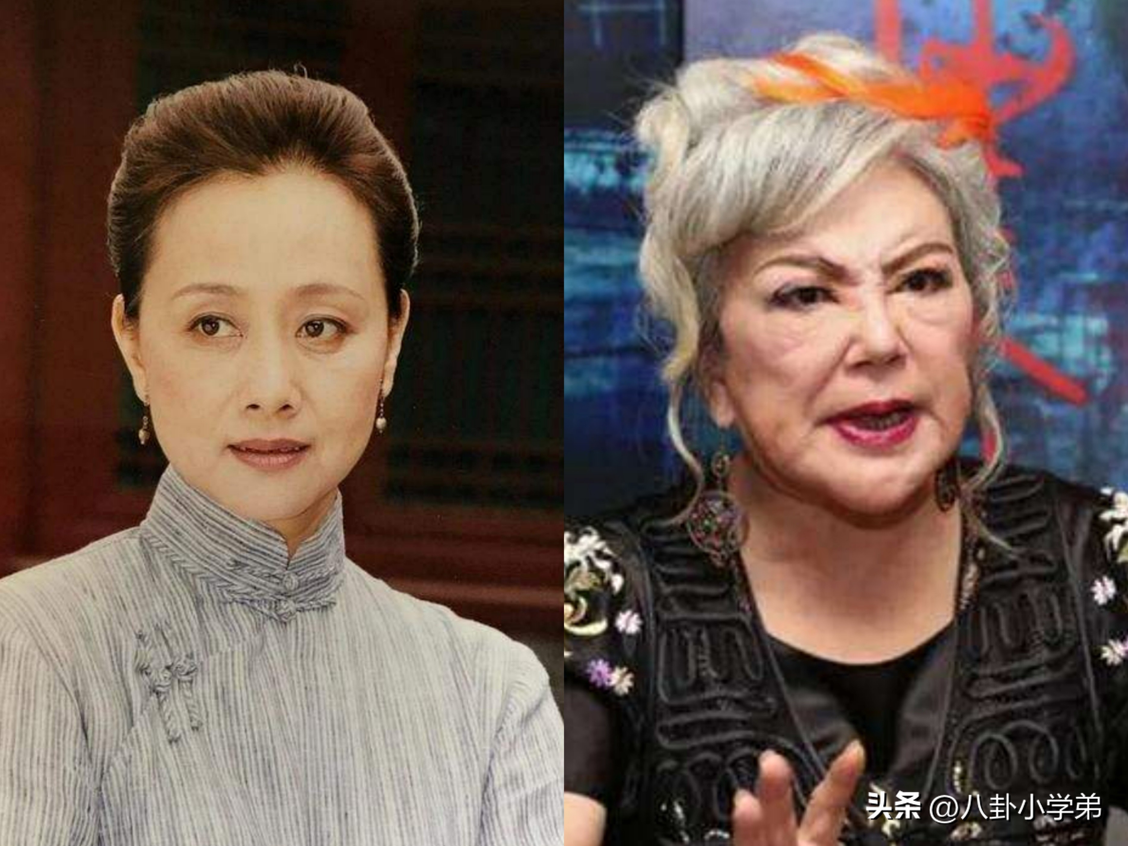 What is the difference between cosmetic aging and graceful aging?3 ...