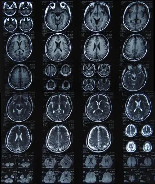 The Greatest Invention in the History of Human Medicine: Nuclear ...