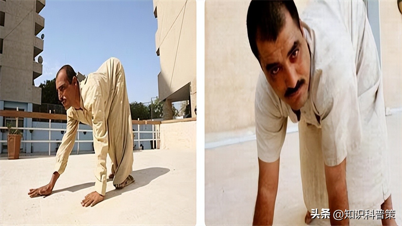 Reverse evolution syndrome: Scientists tell how family lives with only ...