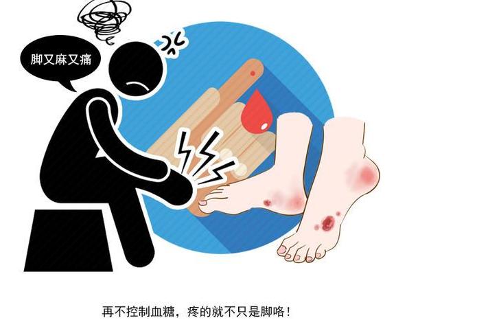 Diabetic patients beware of "rotten feet", it is recommended to do 3 ...