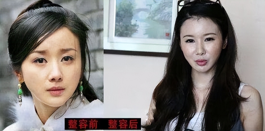 A female star with excessive plastic surgery, her face is stiff and weird, and she ruined her ...