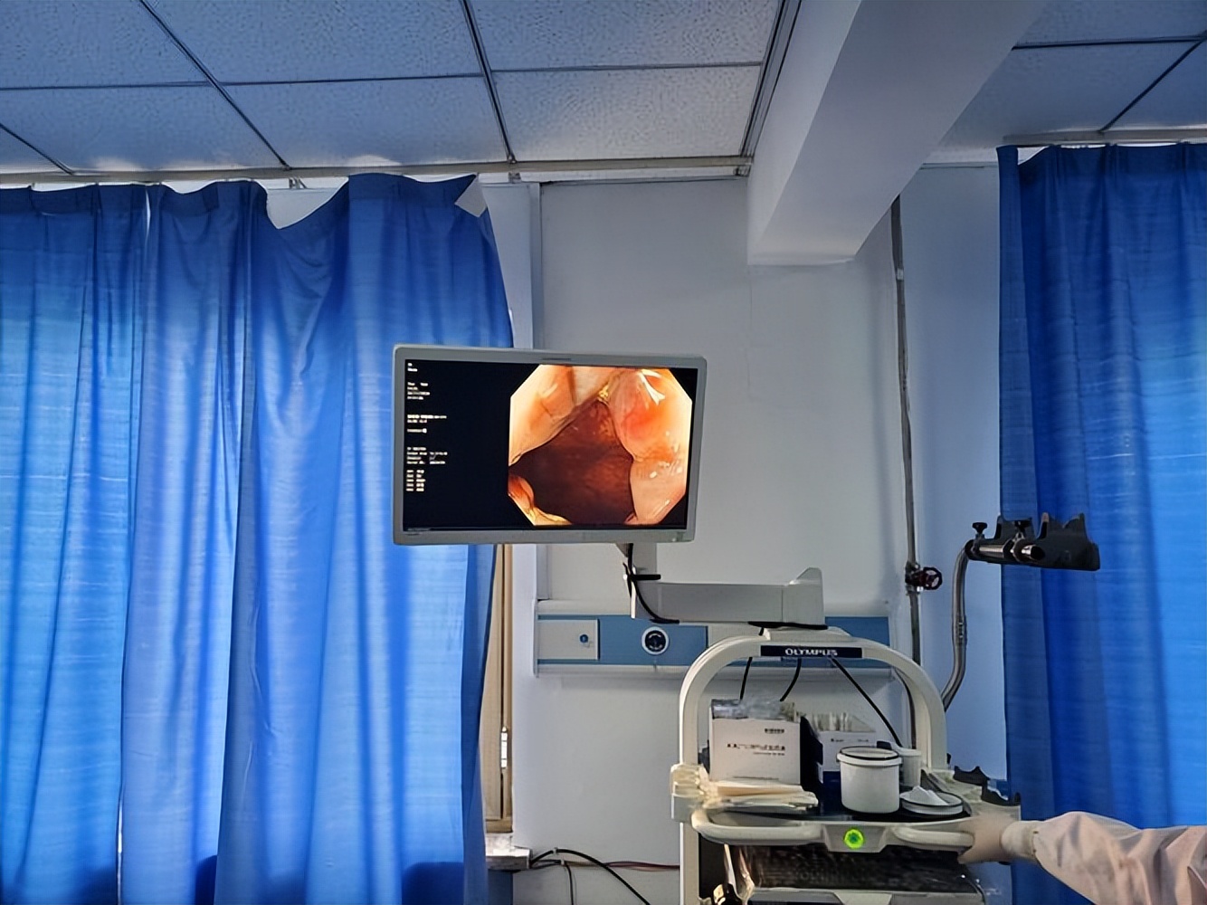 Why do most people reject colonoscopy? How long is the "validity period ...