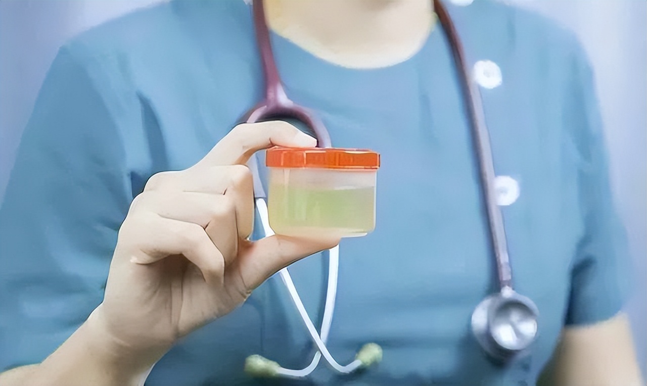 The urine is very yellow, is the body dehydrated, or is it sick?There ...