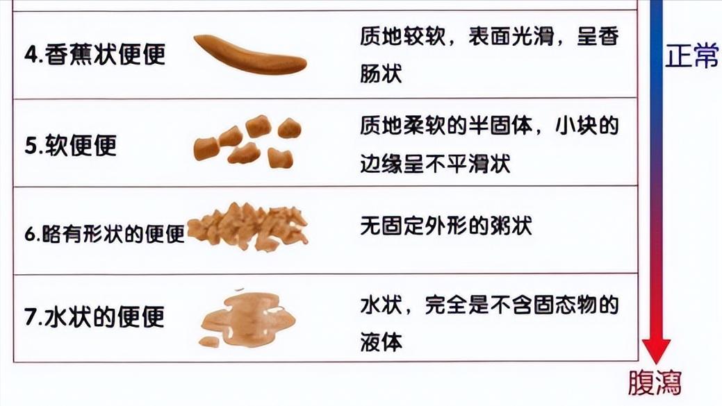 What's the matter with the stool "hard in the front, soft and sticky in ...