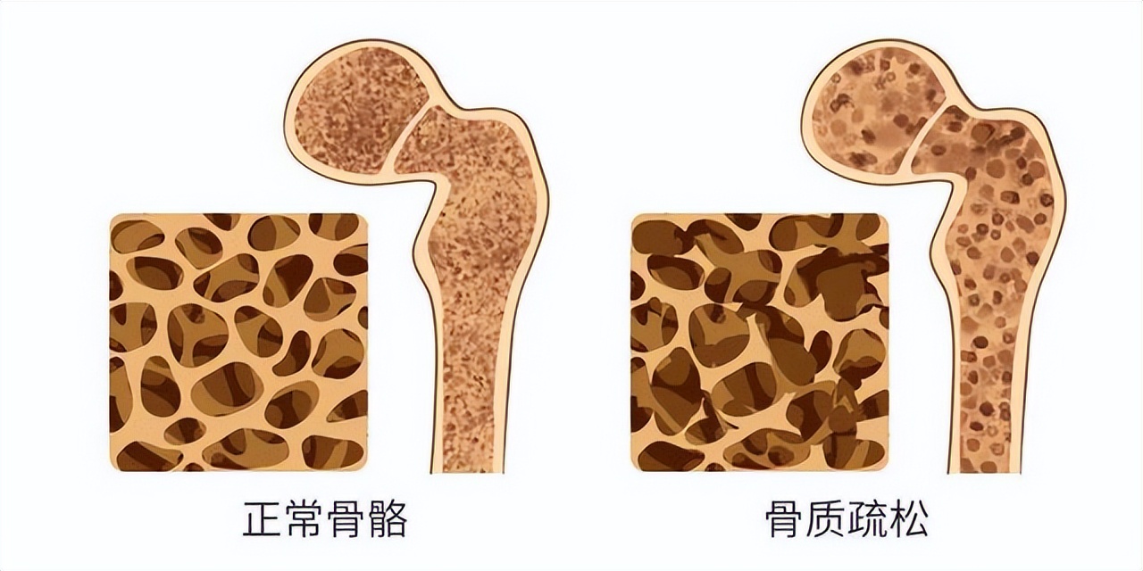 Has the aging sequence of male organs been made public? Men may wish to ...