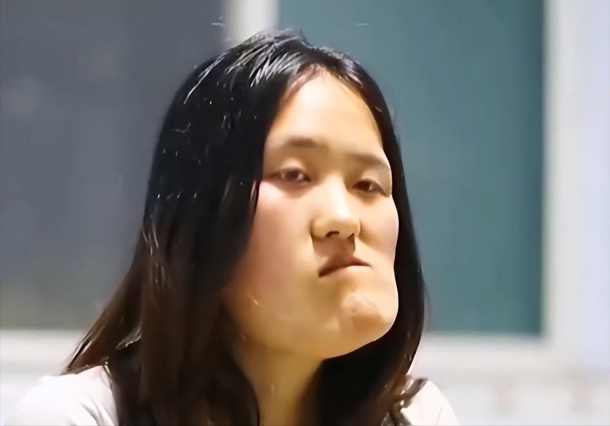 "Crooked Face Girl" Zhao Hongqiu: After plastic surgery, she ...